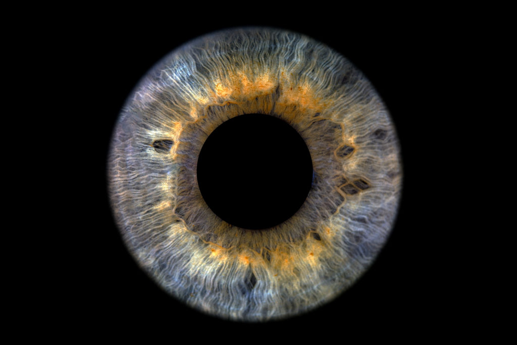 Irisfoto Galerie - Eine Sammlung unserer schönsten Irisshots